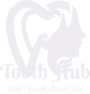 Best Full Mouth Rehabilitation in South Mumbai